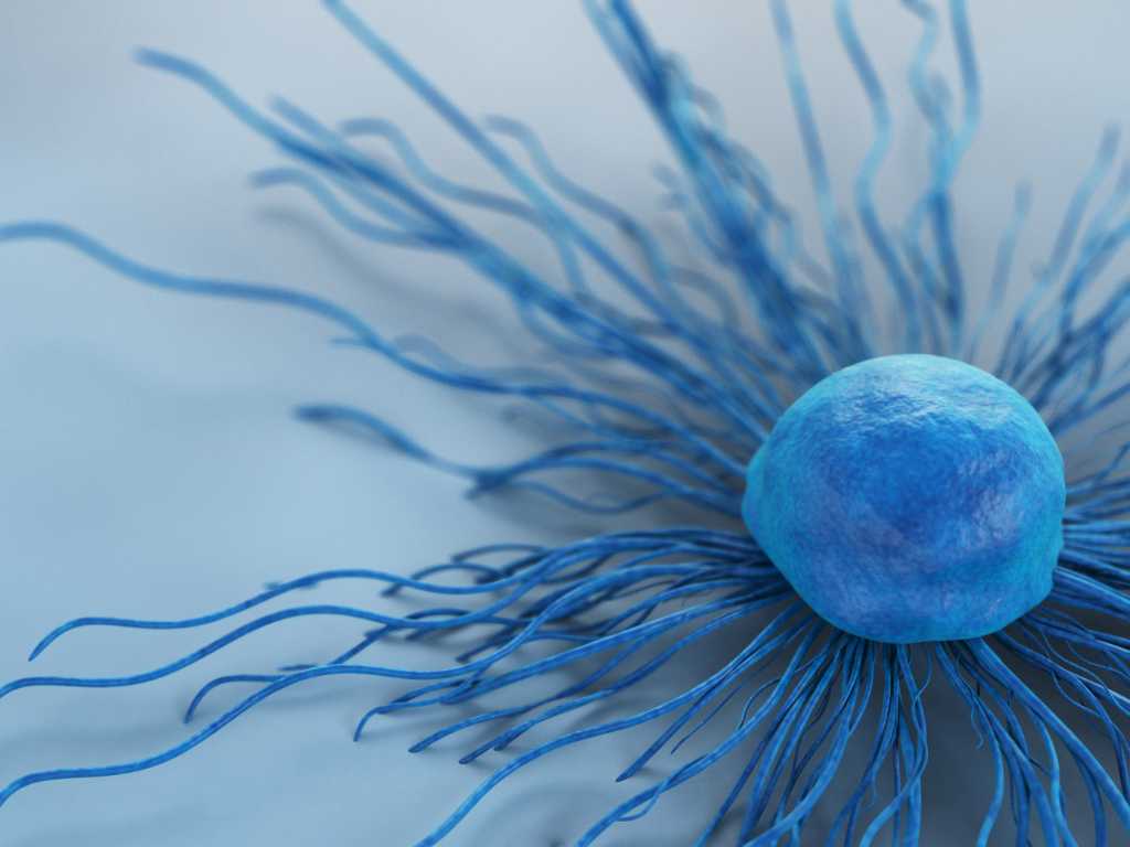 Serviks Kanseri Önlenebilir mi? Serviks Kanserinin 5 Önemli Belirtisi ...